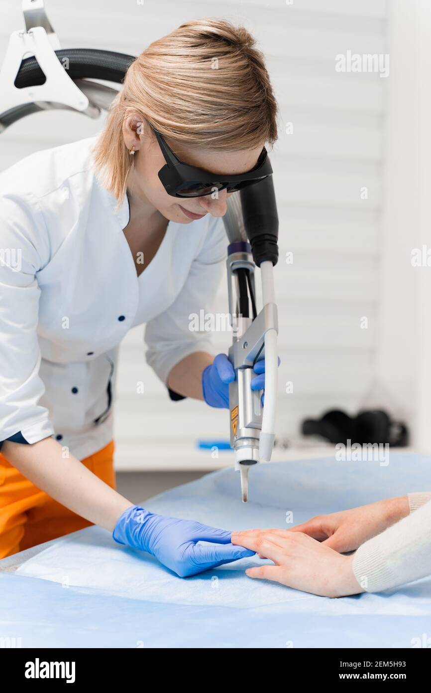 Laser treatment of onychomycosis. fungal infection on the hands of a ...