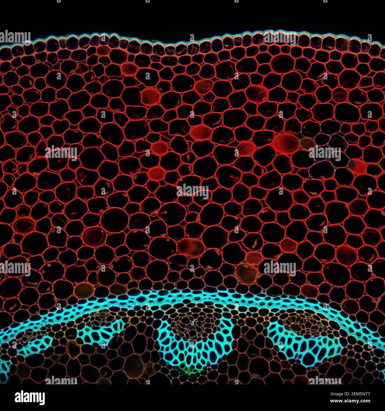 Convallaria plant microscopic sample, fluorescence signal observed with ...