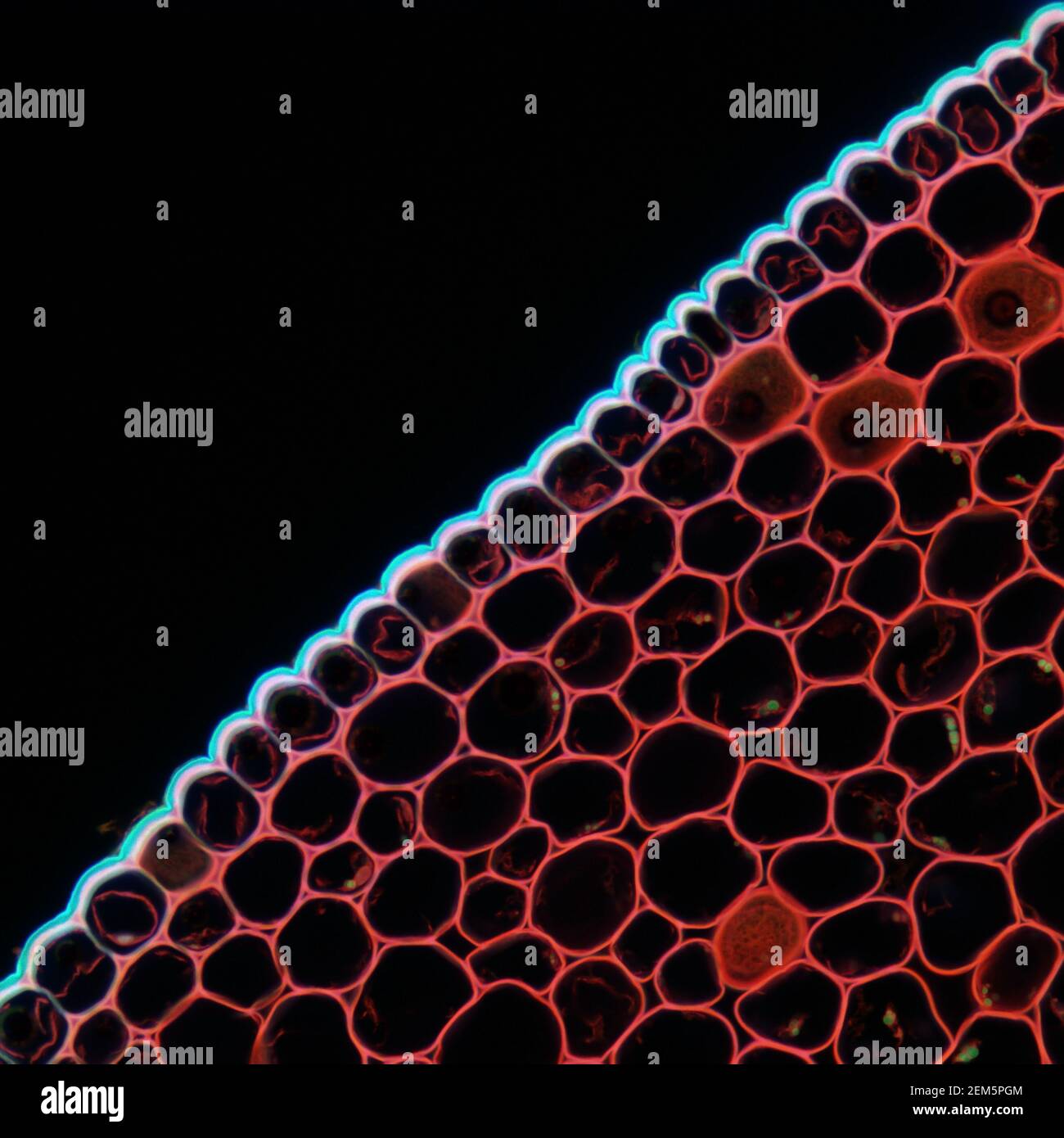 Convallaria plant microscopic sample, fluorescence signal observed with confocal laser scanning ...