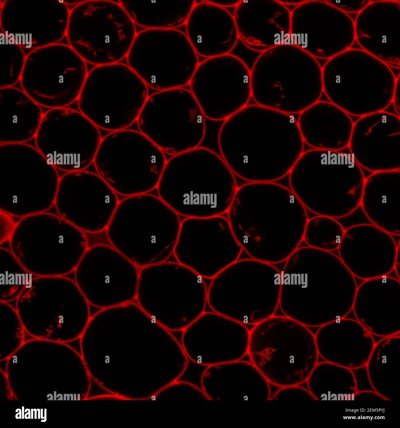Convallaria plant microscopic sample, fluorescence signal observed with ...
