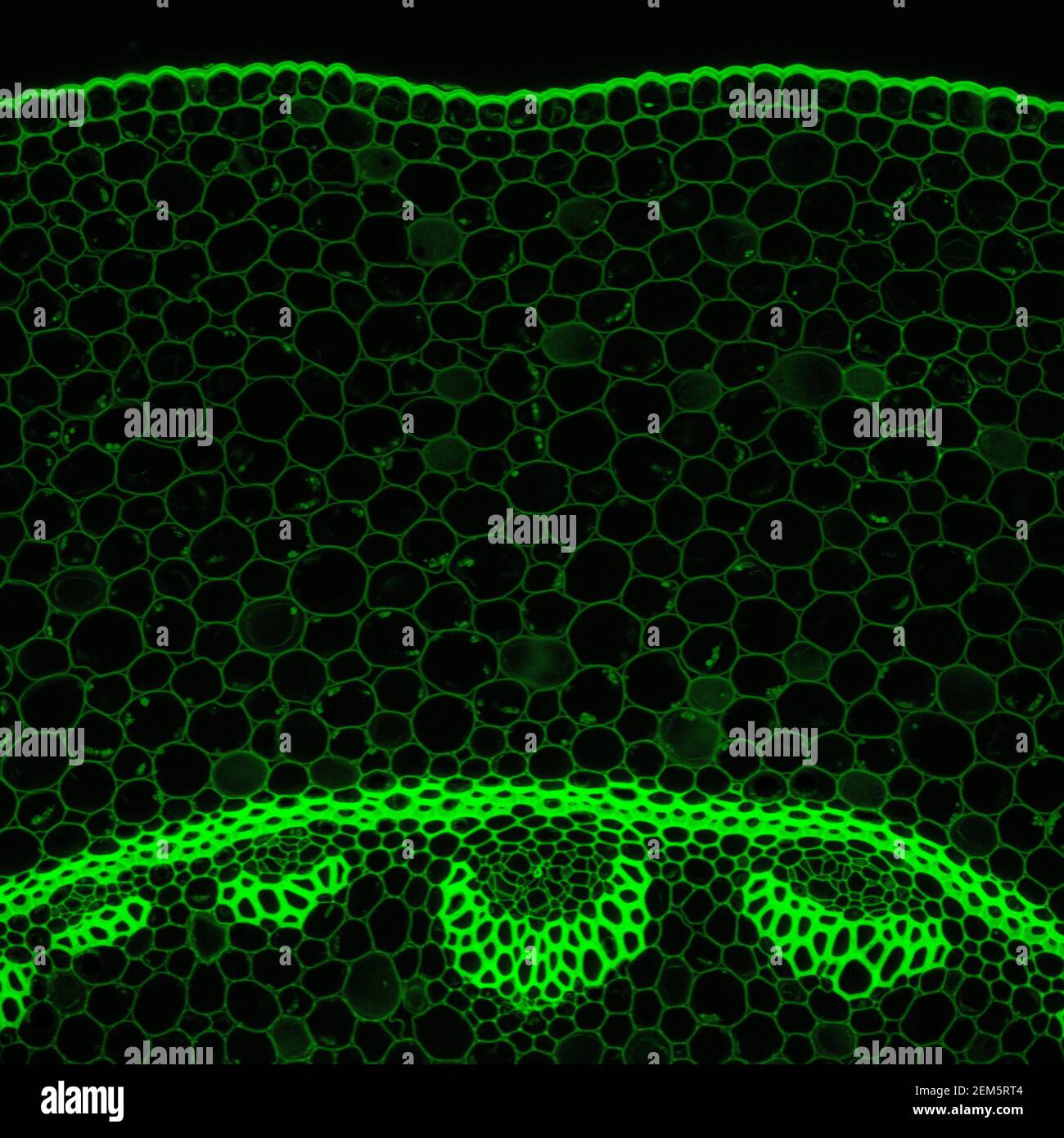 Convallaria plant microscopic sample, fluorescence signal observed with ...