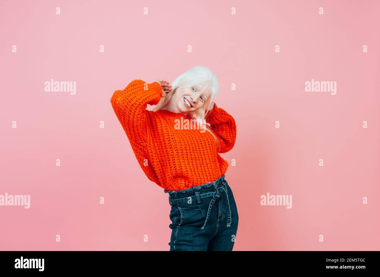 Lidestyle image of an albino girl posing in studio. Concept about body ...