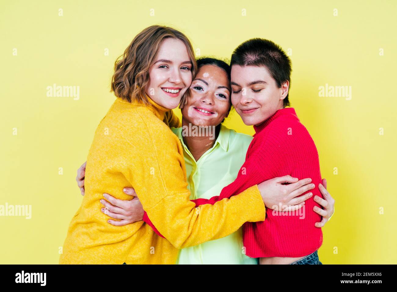 group of multiethnic women with different kind of skin posing together ...