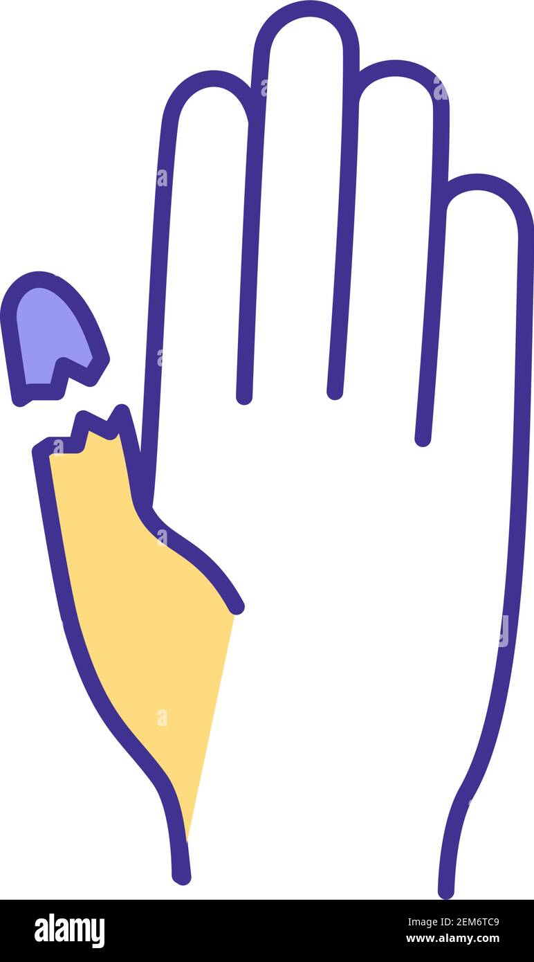 Avulsion Wound Animated Avulsion Of Skin: Top 10 Essential Steps To