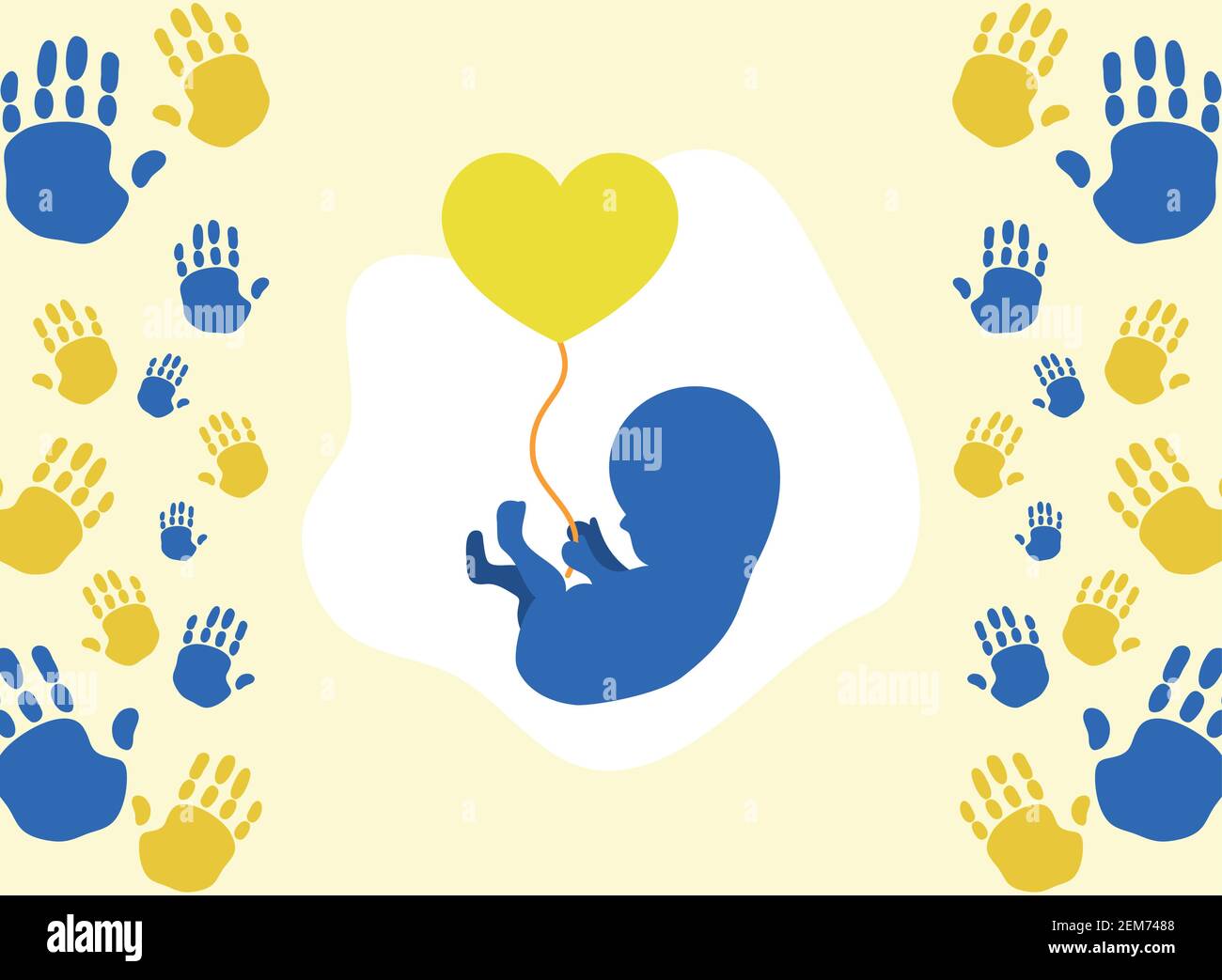 Down Syndrome Footprint