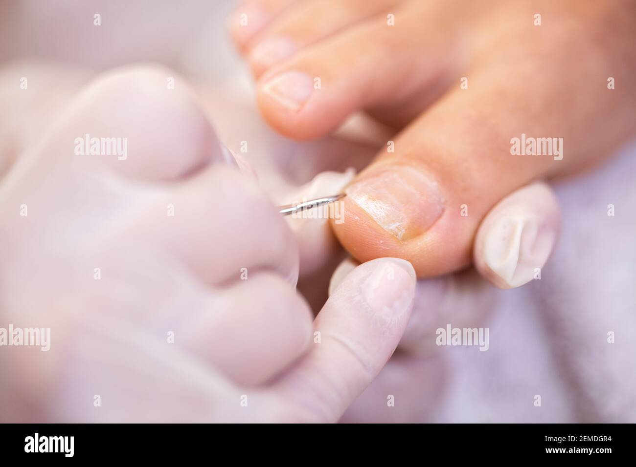 Cleaning toenail hi-res stock photography and images - Alamy