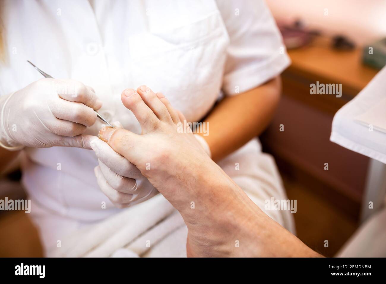 Feet big toe pedicure, cuticle treatment, men’s pedicure, cuticle nail ...