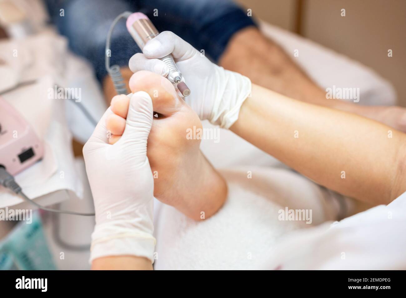 Pedicure treatment of the skin area around the big toe, men’s feet ...