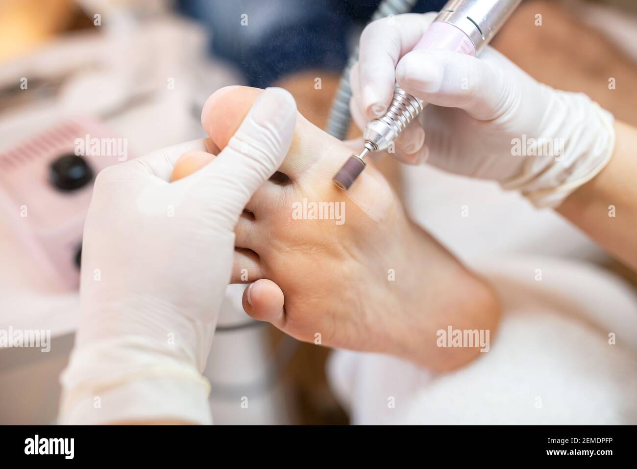 Foot pedicure treatment, big toe skin area, rotating skin pedicure file ...