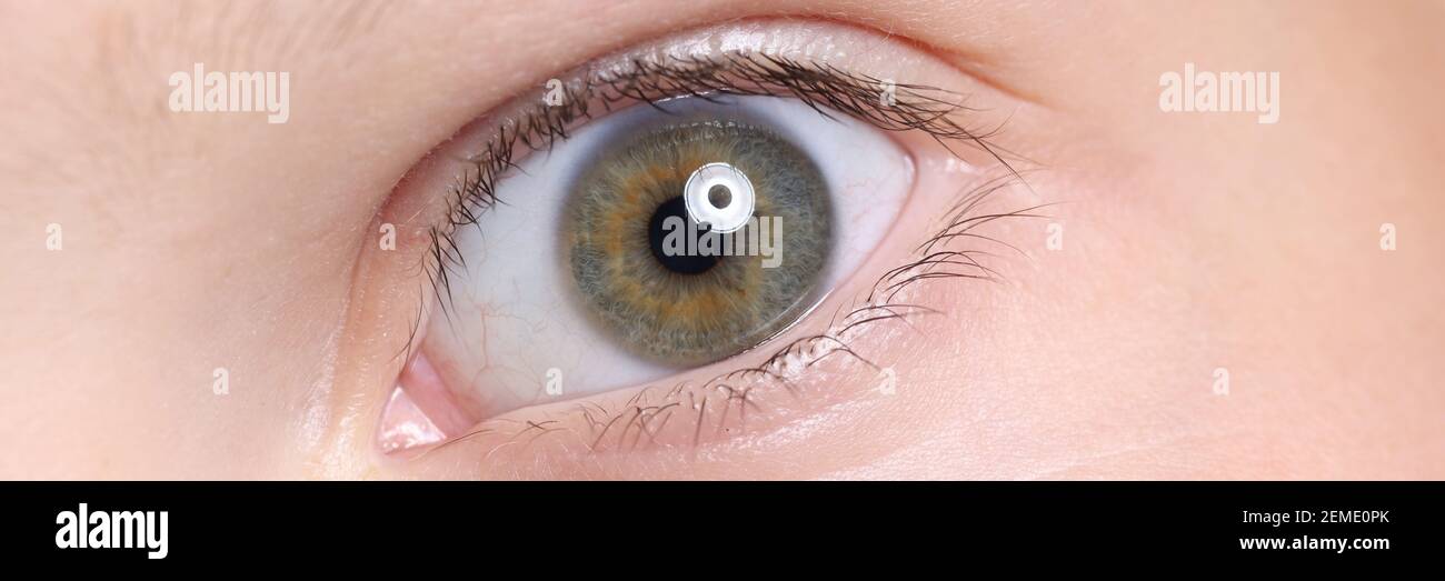 Wide open child's eye with an eyebrow and moles on skin Stock Photo - Alamy