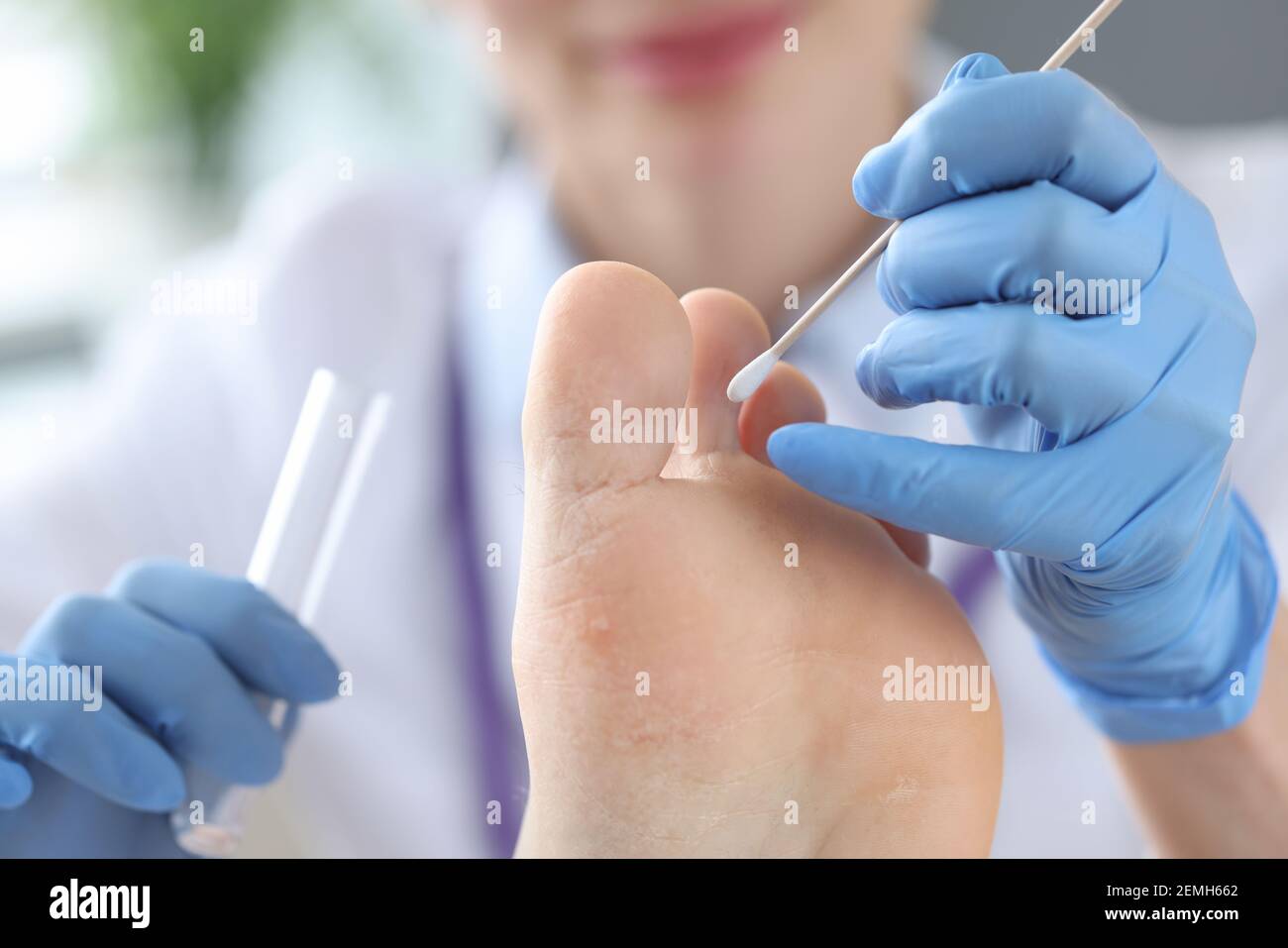 Medical procedure scraping skin foot hi-res stock photography and ...