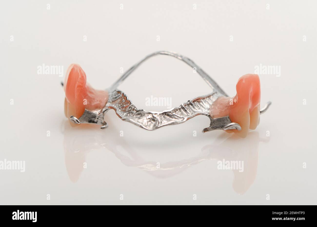 Set of pictures with a Partial denture cast and denture showing missing ...