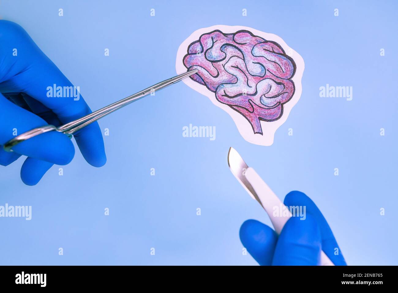Brain Surgery Clipart