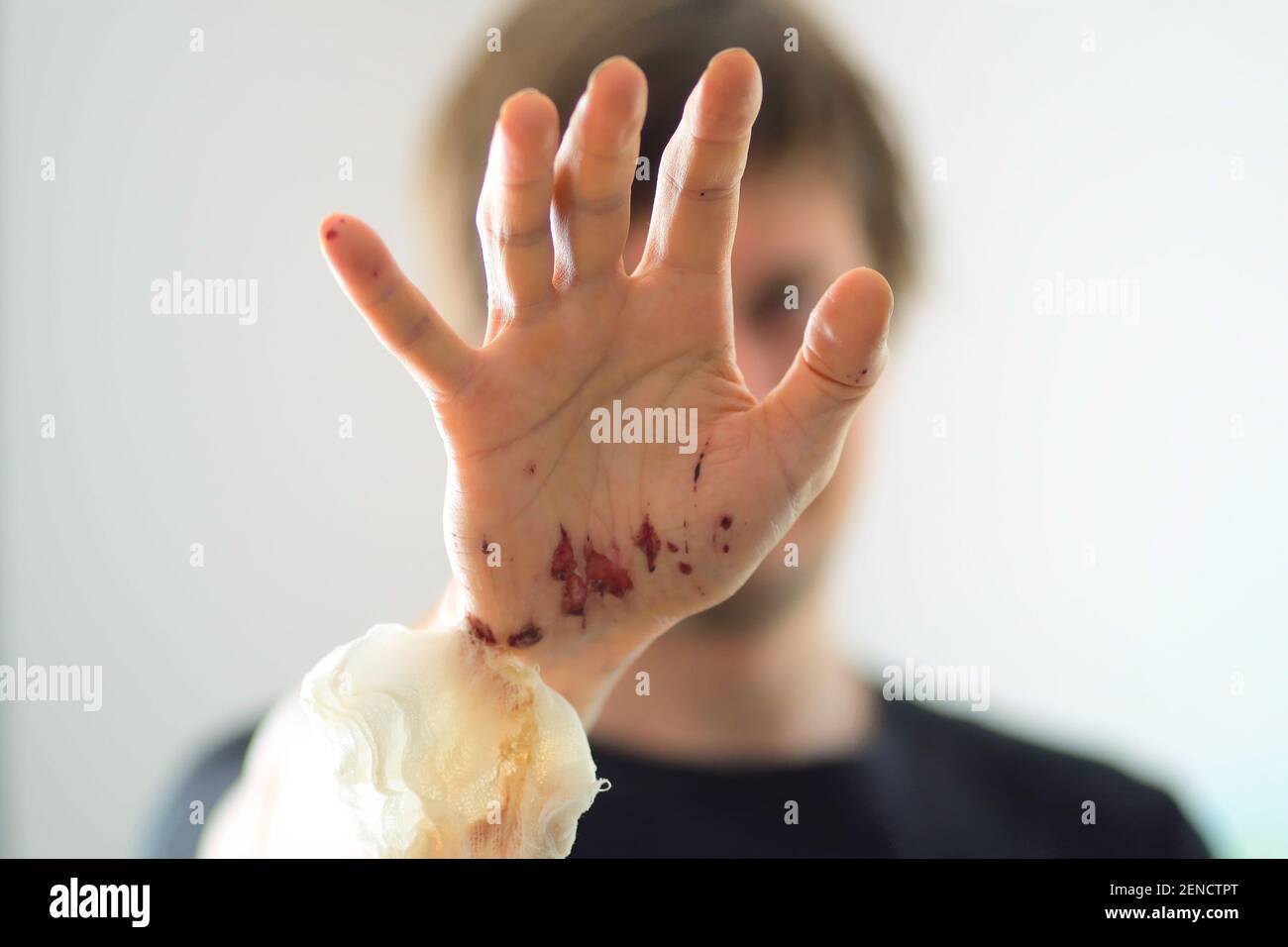 Back scratches hi-res stock photography and images - Alamy