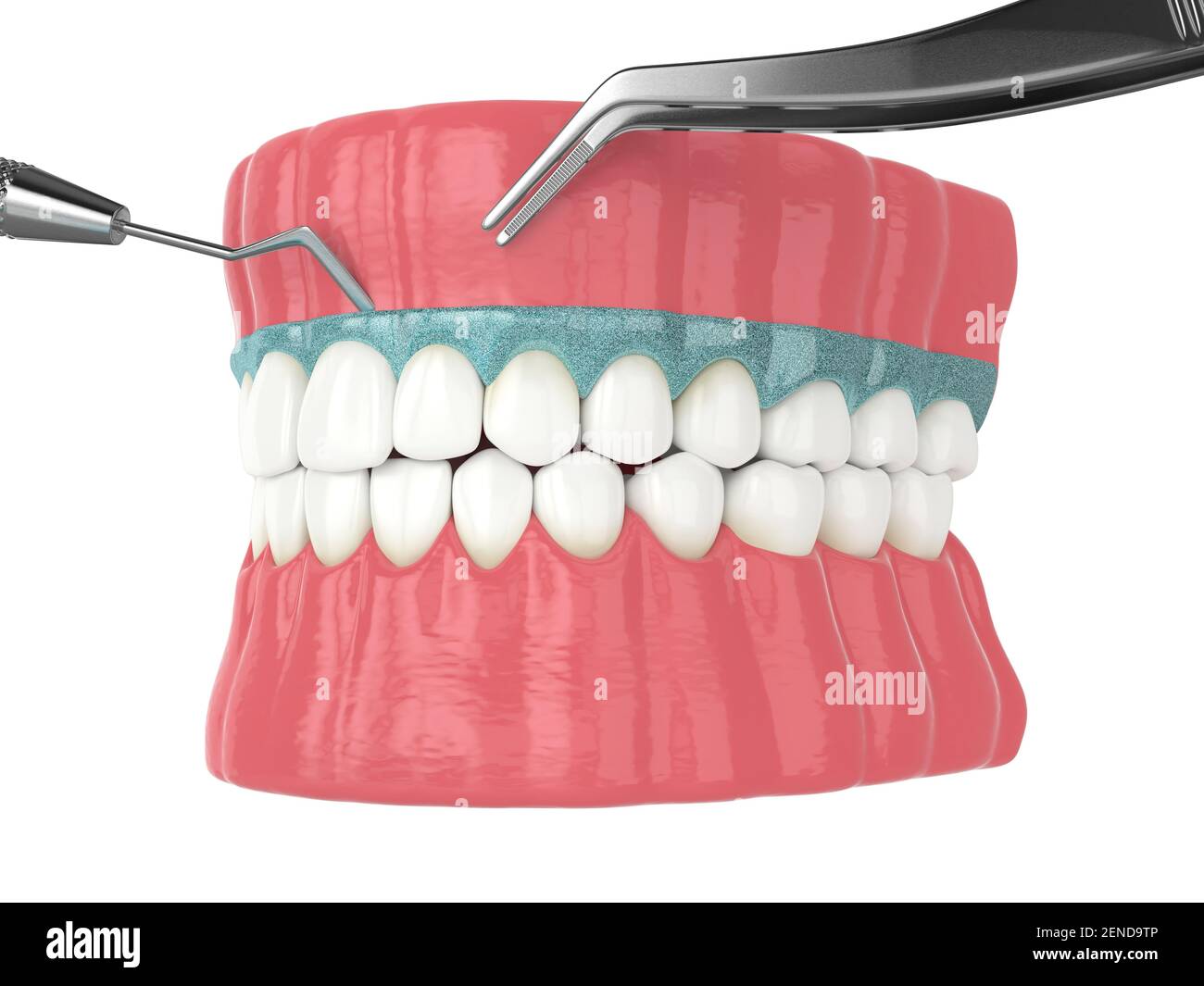 3d render of jaw with removing the silicone mask from the gums ...