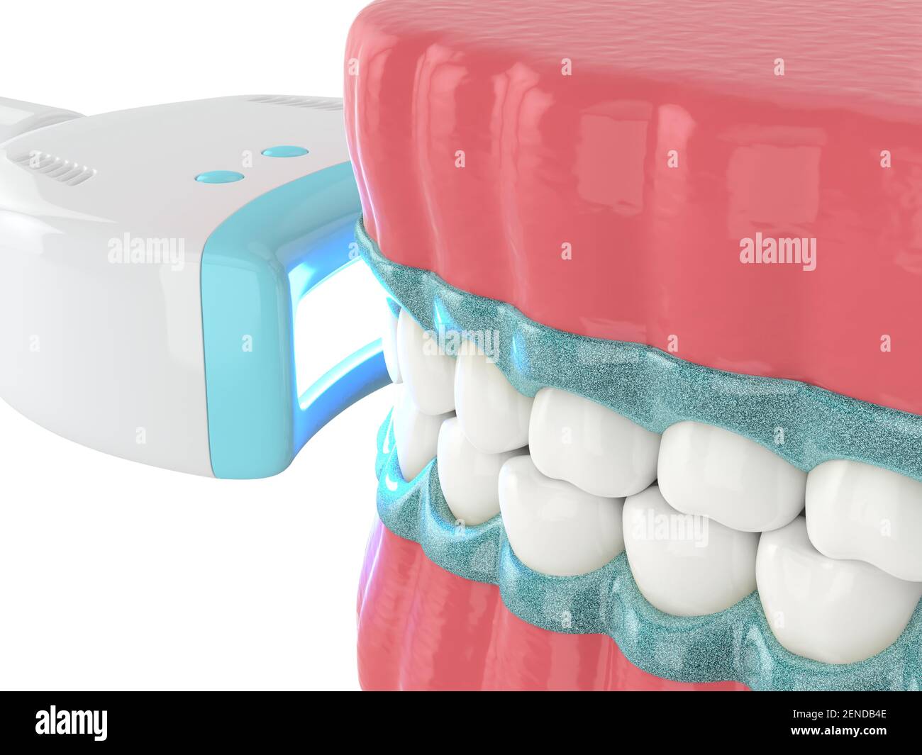 3d render of jaw with teeth bleaching by uv lamp. Teeth whitening ...