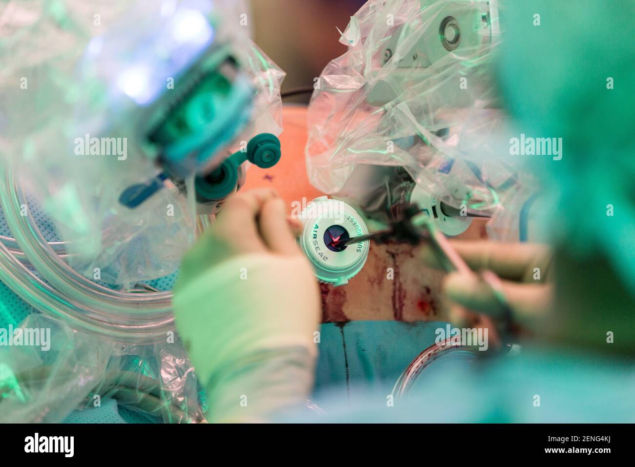 Surgeons perform an operation in an nhs hospital hi-res stock ...