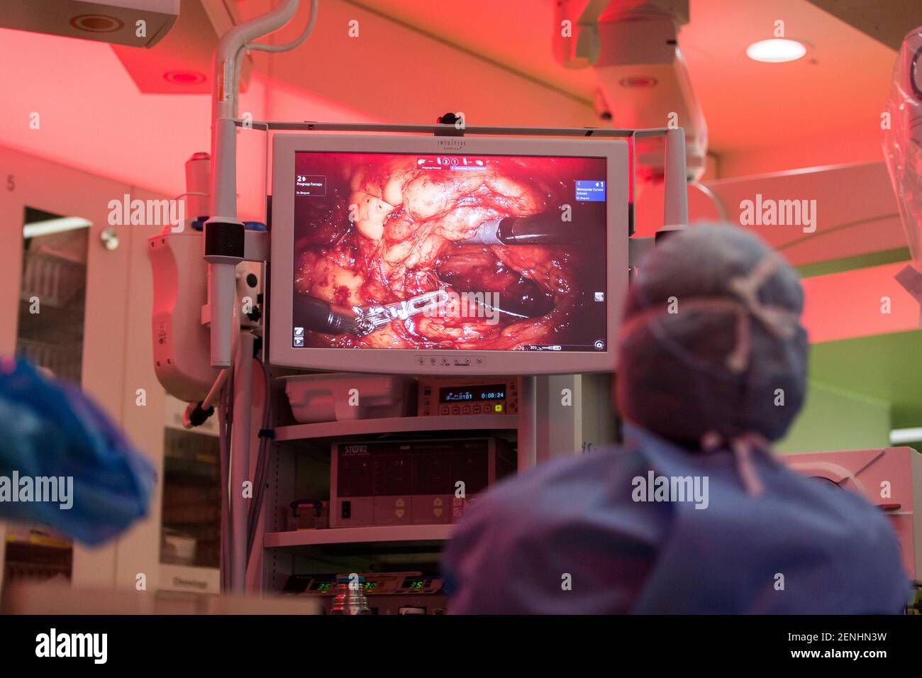 Surgeons perform an operation in an nhs hospital hi-res stock ...