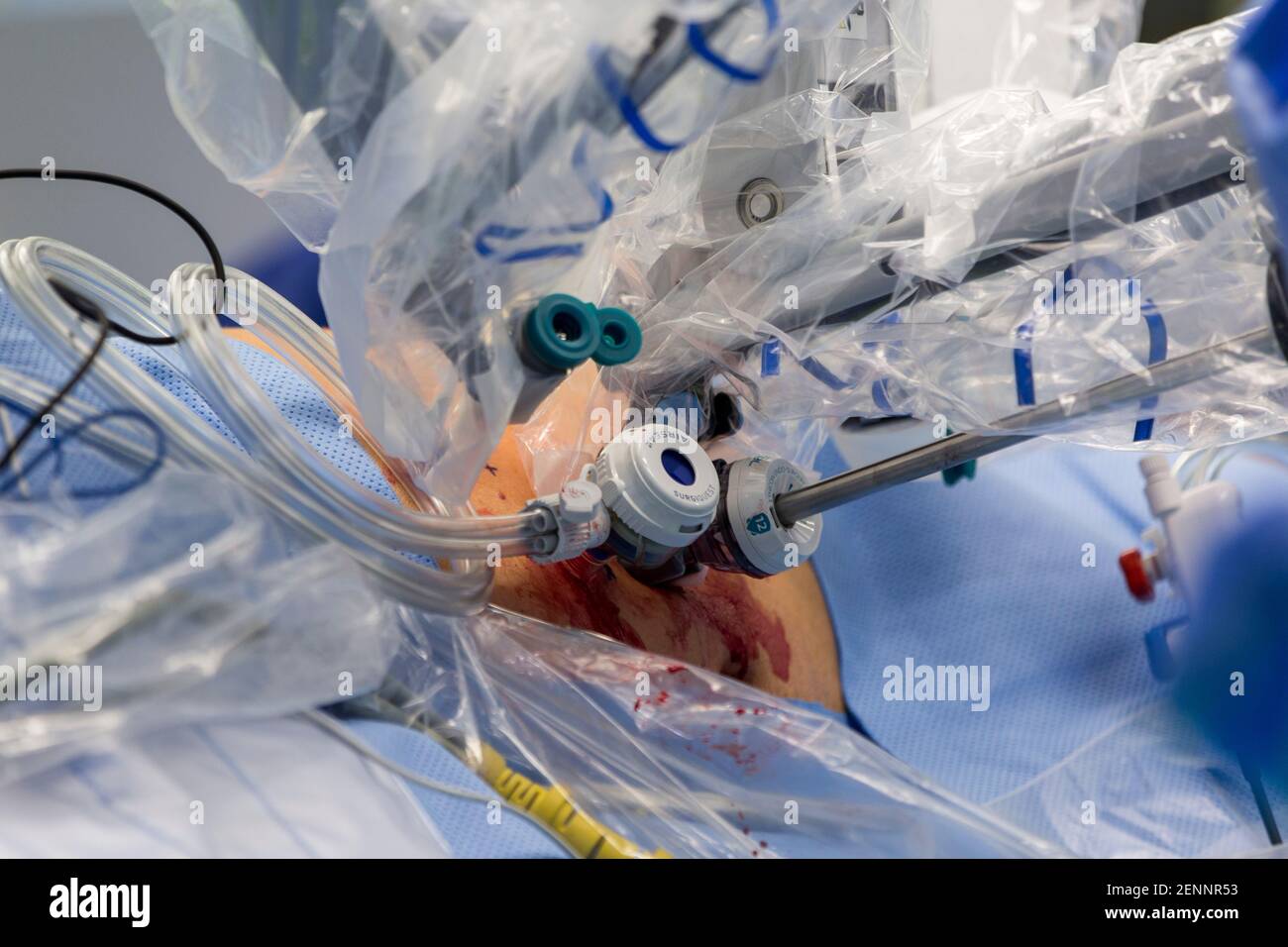 Surgeons perform an operation in an nhs hospital hi-res stock ...