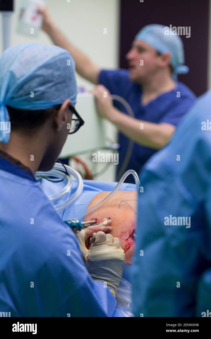 Surgeons perform an operation in an nhs hospital hi-res stock ...
