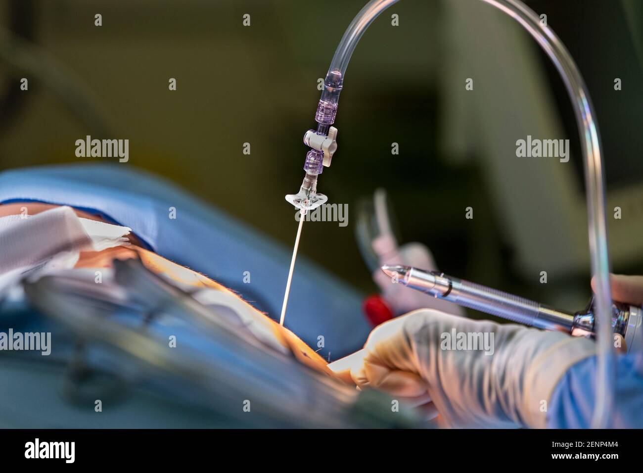 Doctors & Surgeons perform operation Stock Photo - Alamy