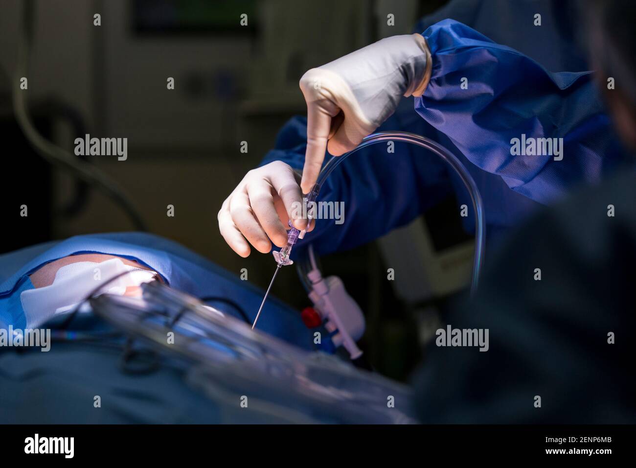 Doctors & Surgeons perform operation Stock Photo - Alamy