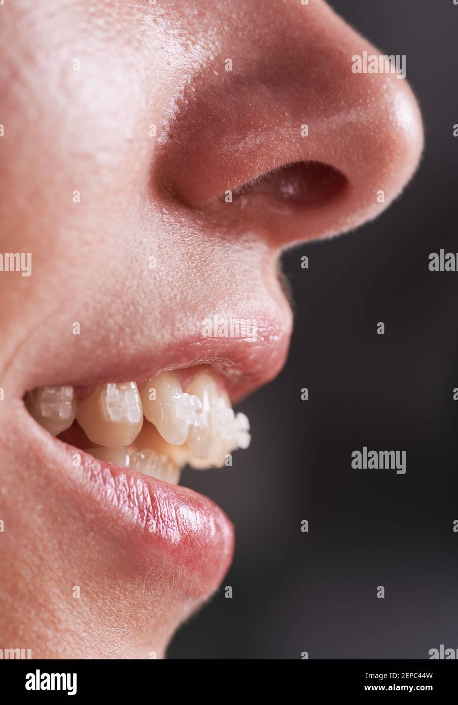 Close up of young woman with opened mouth demonstrating white teeth ...