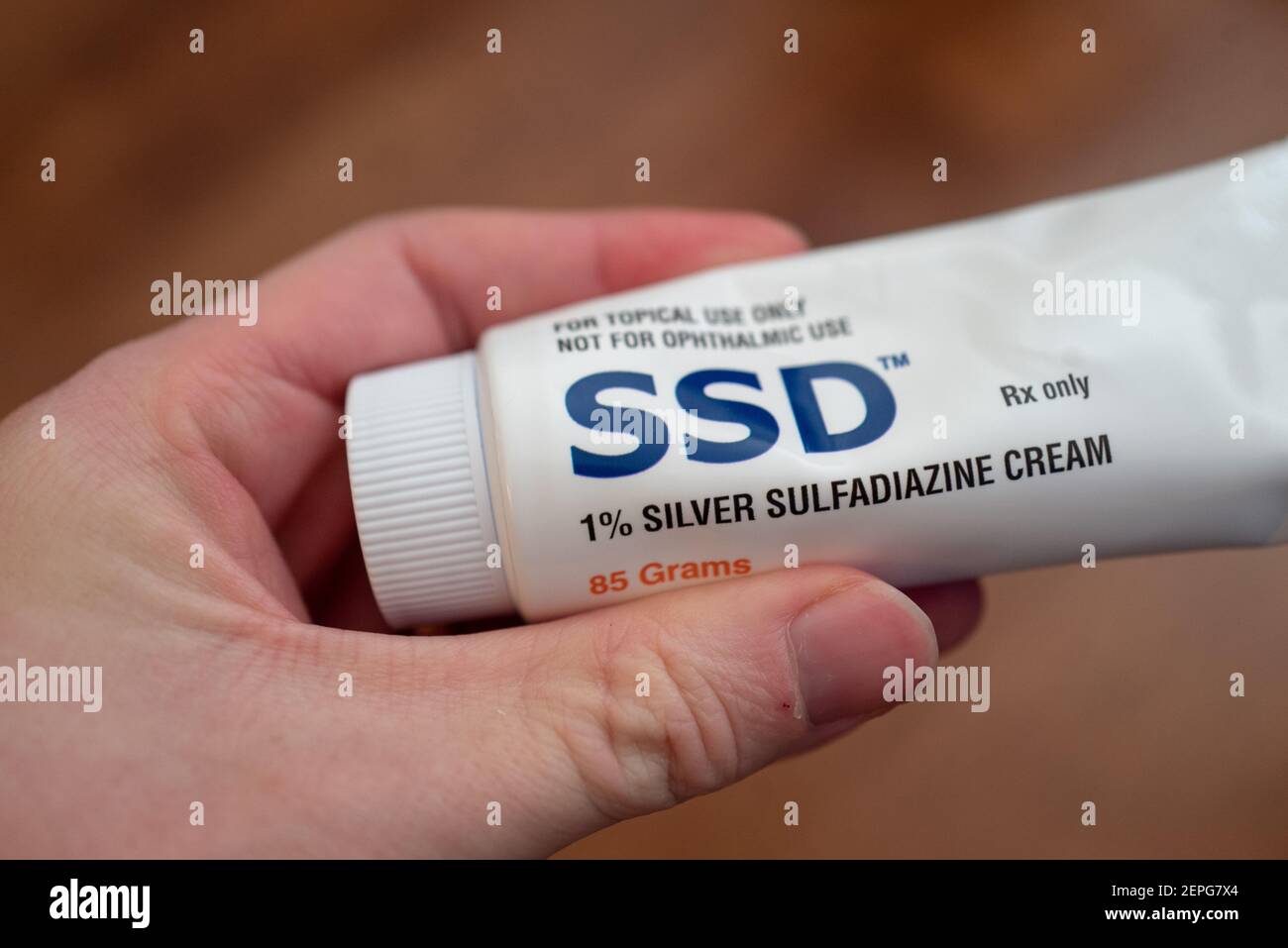Close-up of hand of a man holding silver sulfadiazine cream, often used ...