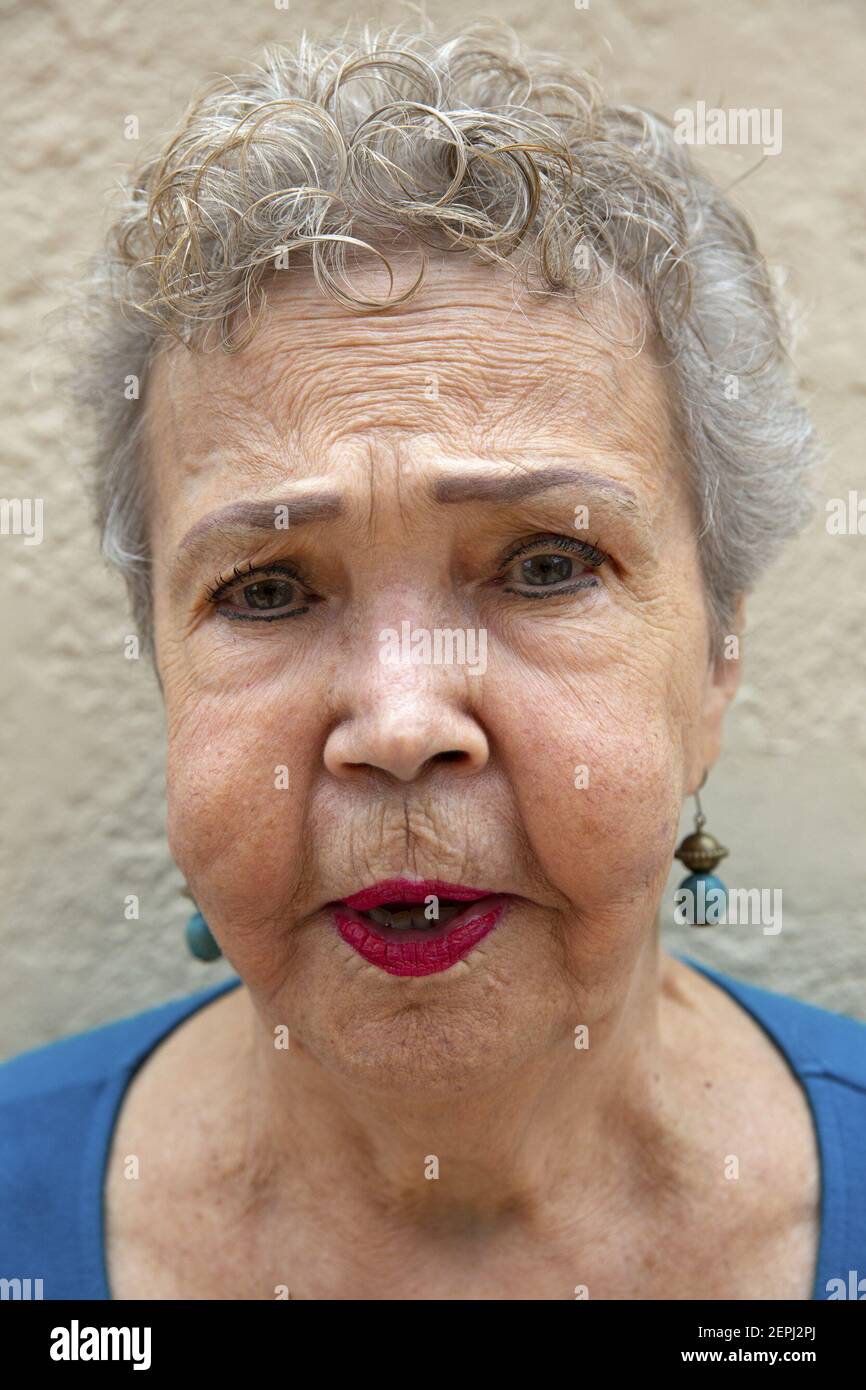 Dermatopathology hi-res stock photography and images - Alamy