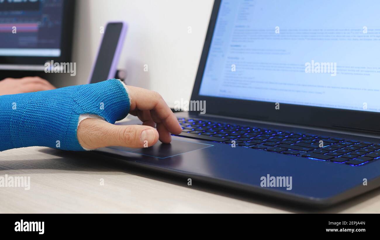 Fiberglass cast wrist hi-res stock photography and images - Alamy