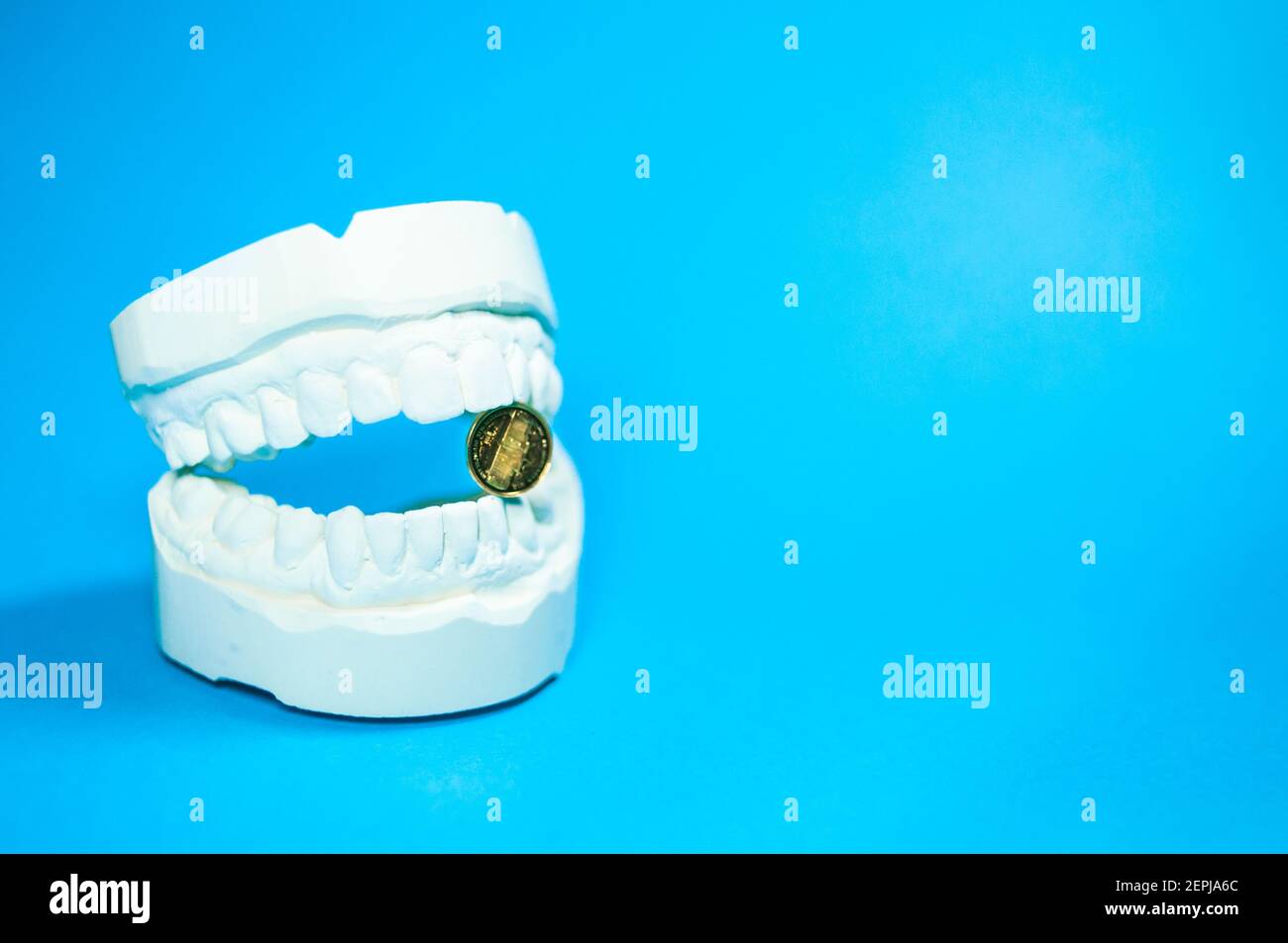 View of the impression of a bit, with the upper and lower jaw in front ...