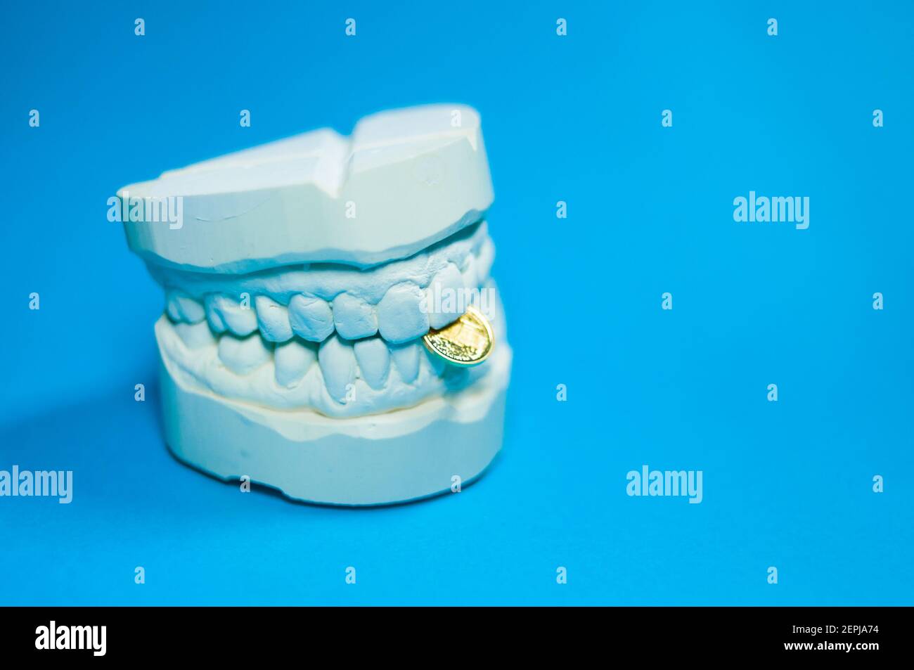 View of the impression of a bit, with the upper and lower jaw in front ...