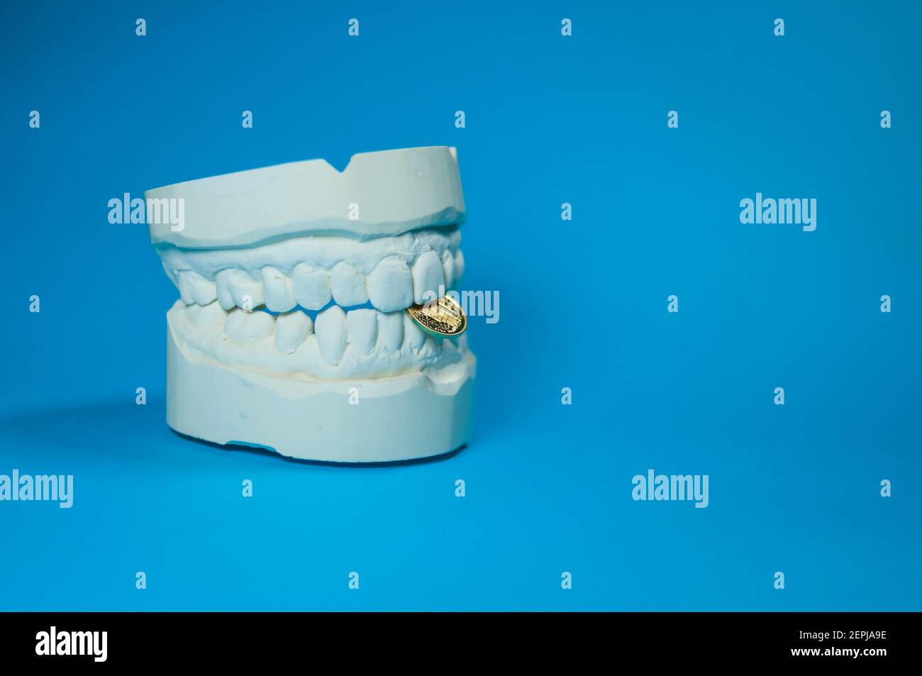 View of the impression of a bit, with the upper and lower jaw in front ...