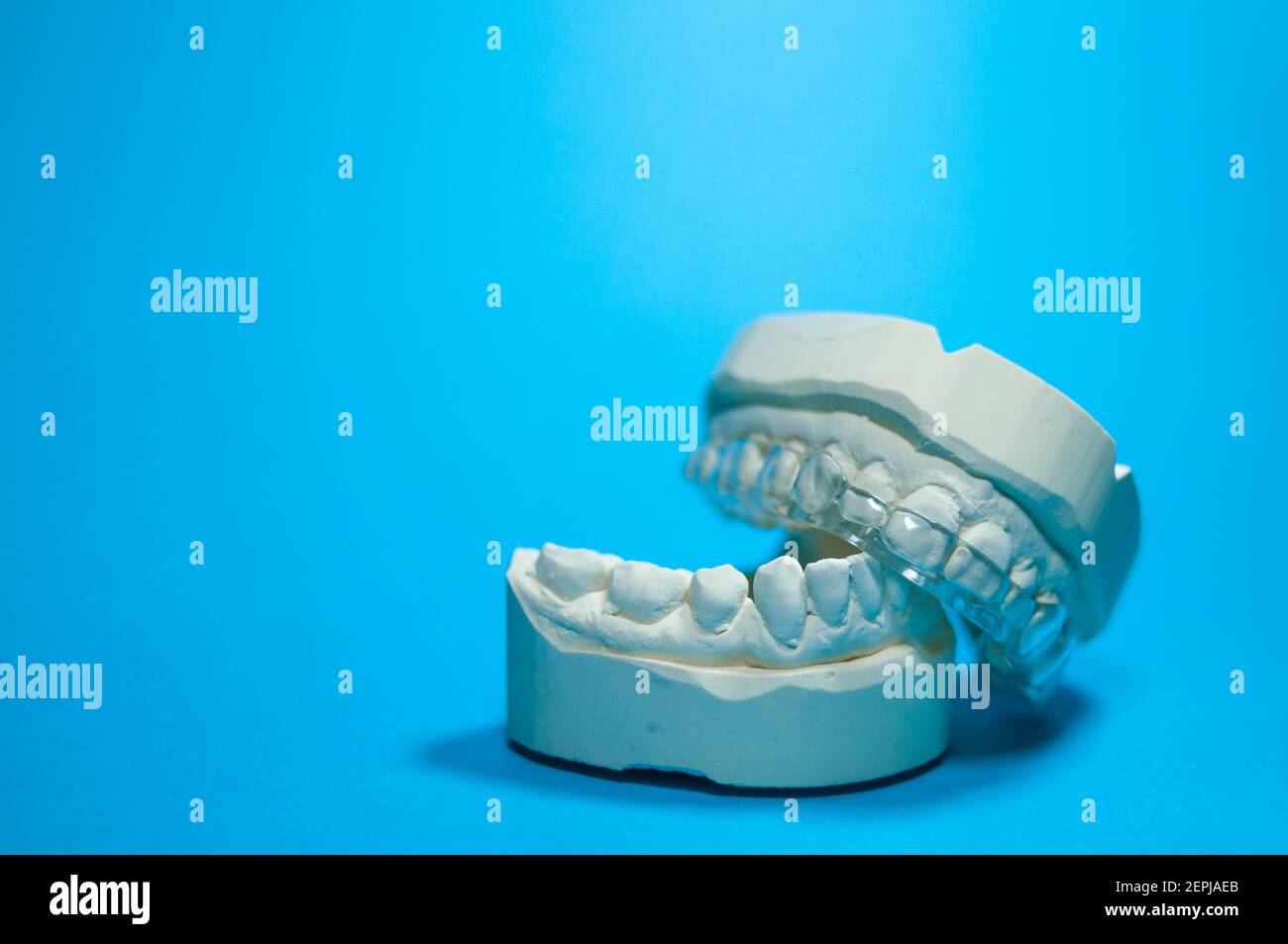 Rail dental splint hi-res stock photography and images - Alamy