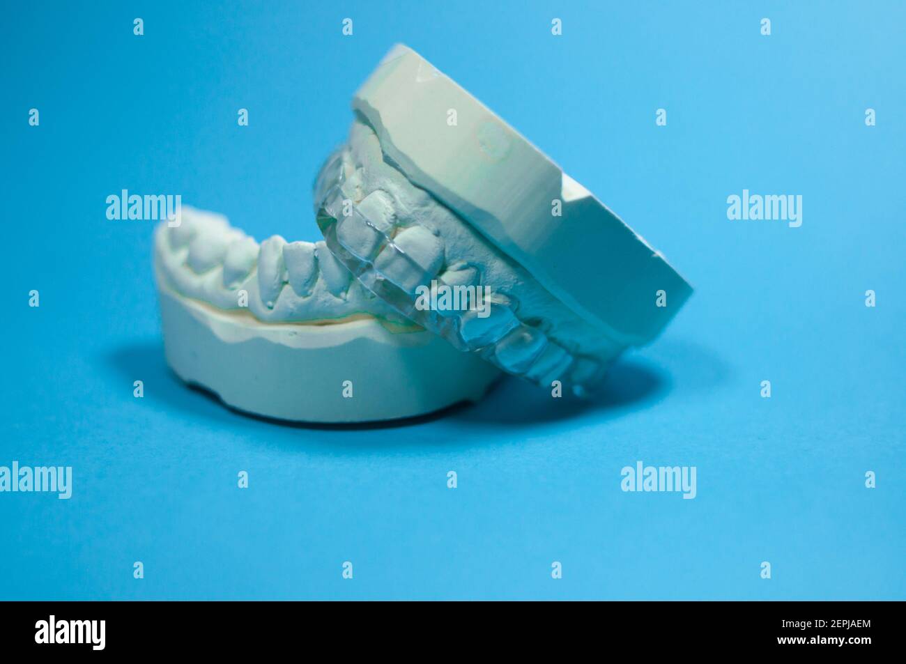 imprint of an upper jaw and lower jaw. there is a dental splint on the ...