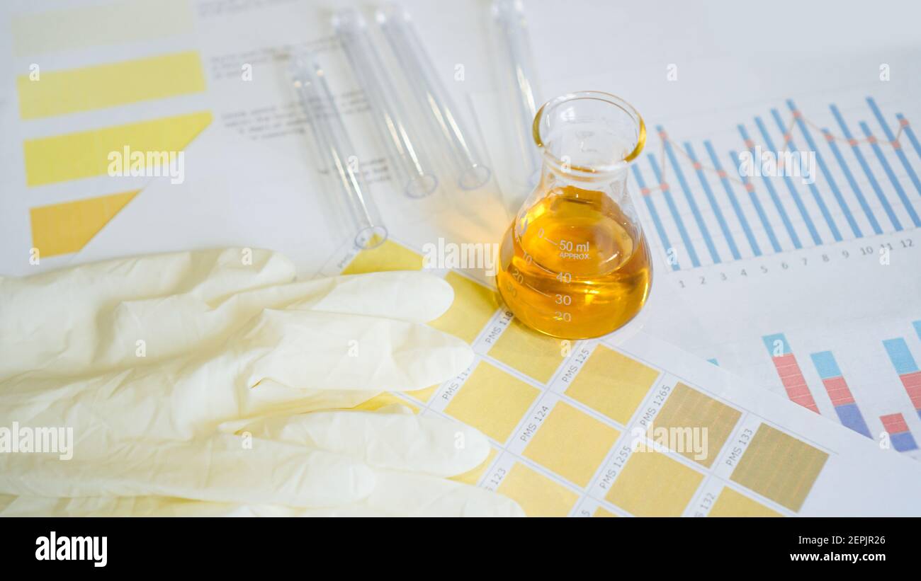 Urine test. Flask with analyzes on medical tables with color ...