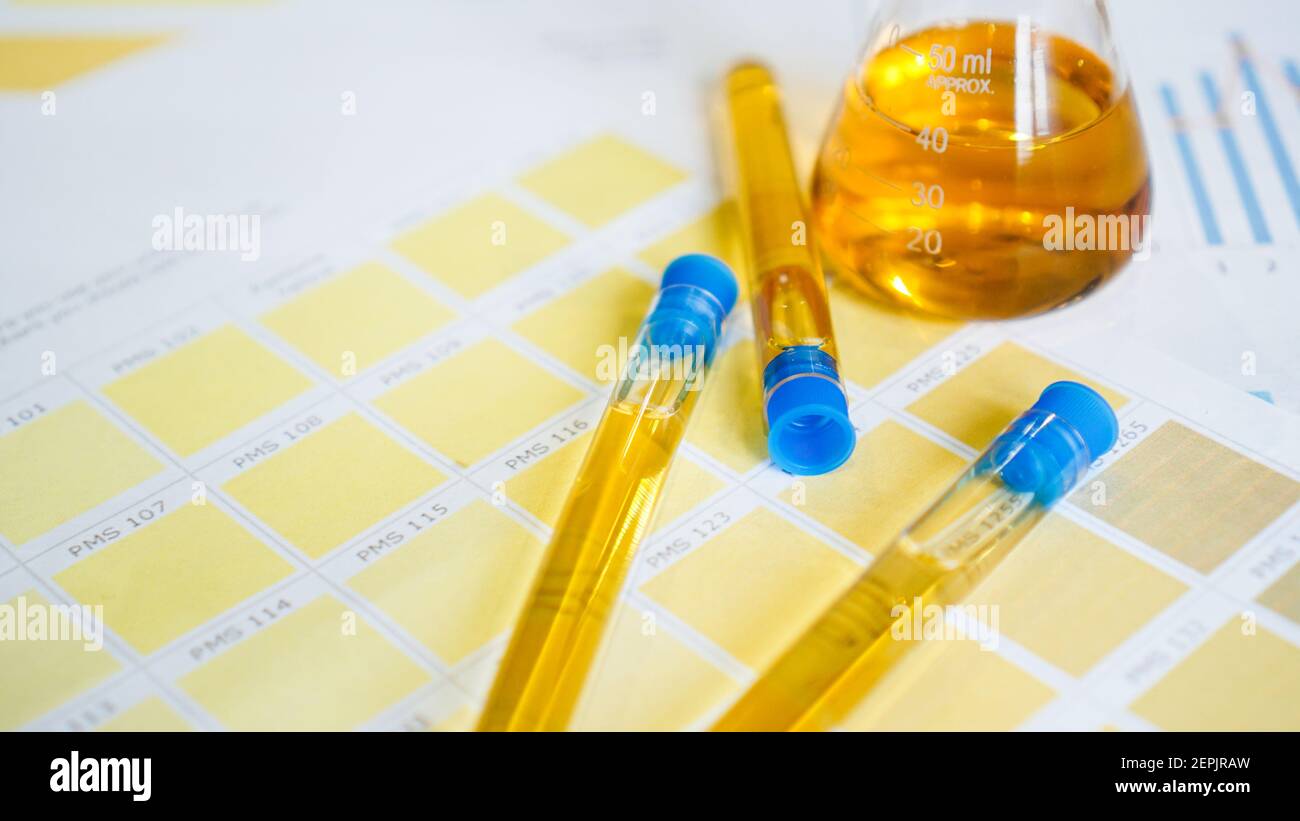 Flask and test tubes with urine on medical color schemes. The concept ...