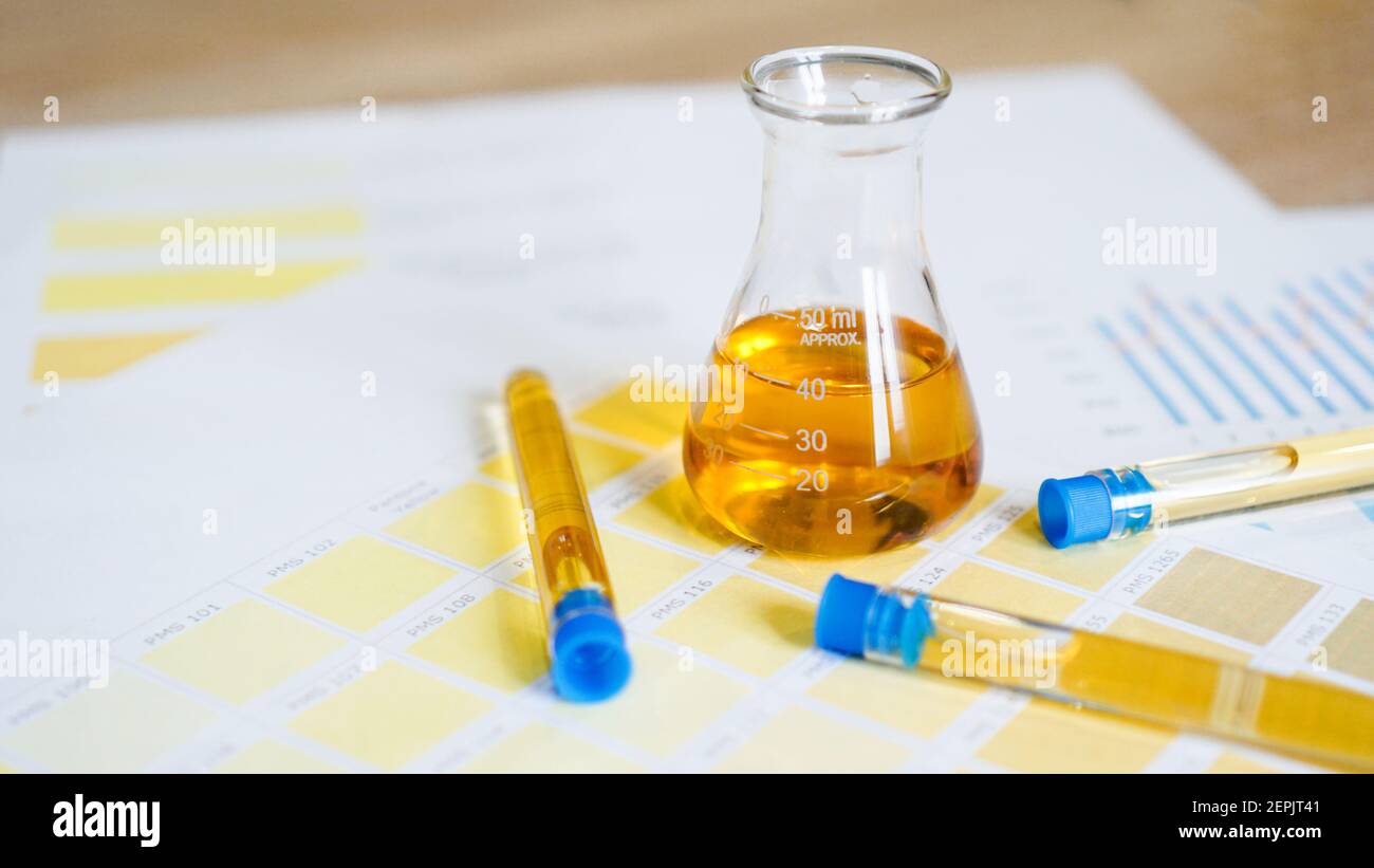 Flask and test tubes with urine on medical color schemes. The concept ...