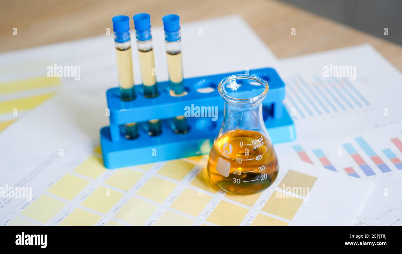 Flask and test tubes at the stand with urine on medical color schemes ...