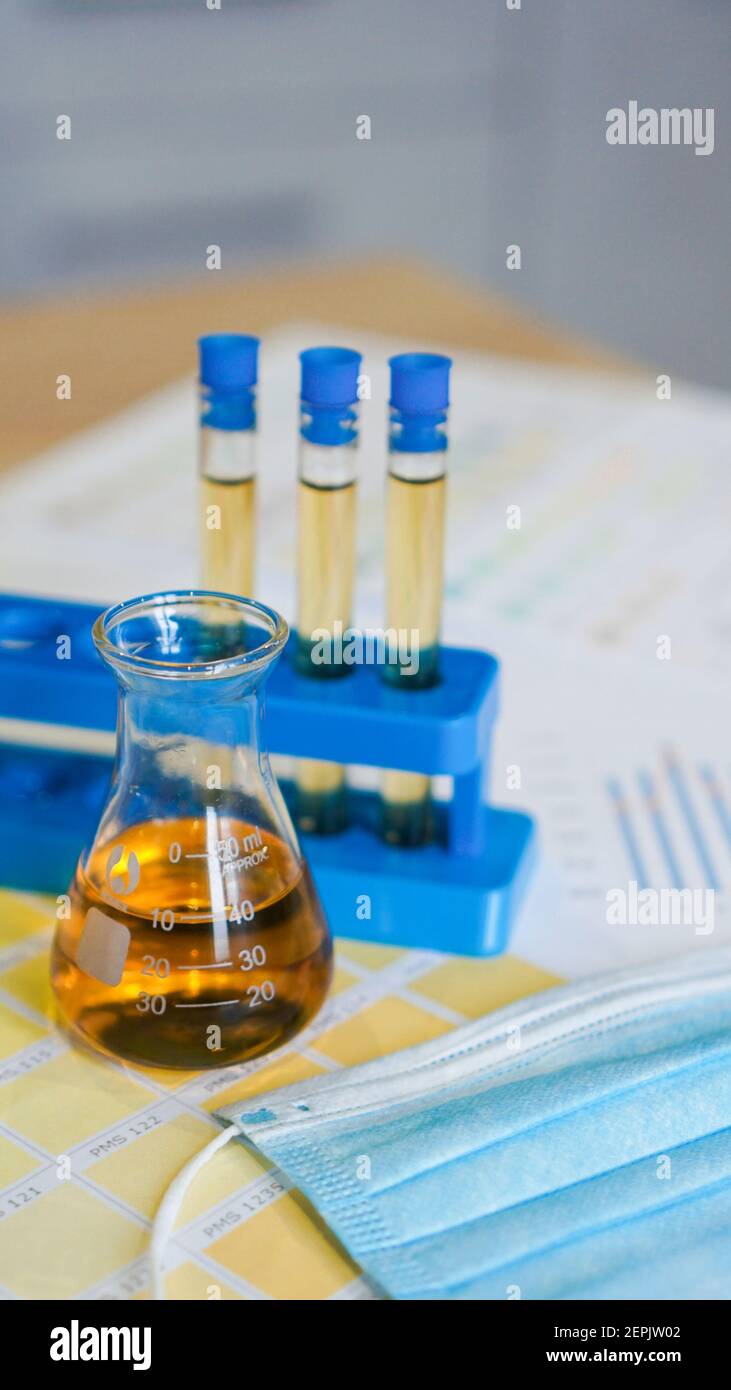Flask and test tubes with urine on medical color schemes. The concept ...