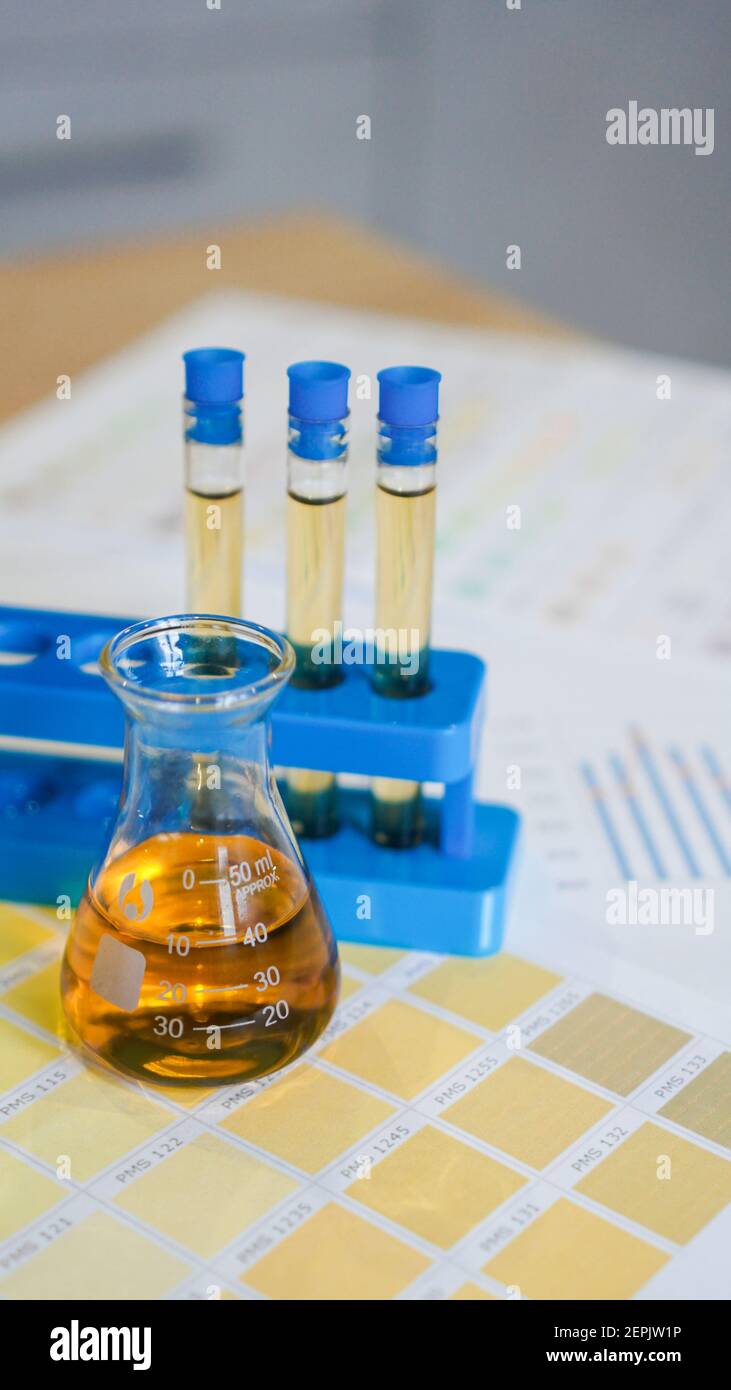 Flask and test tubes with urine on medical color schemes. The concept ...