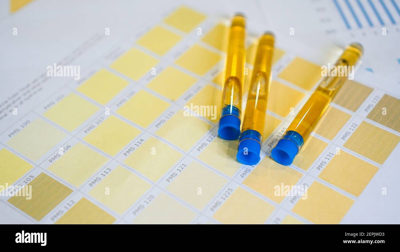Closed urine tubes are placed on color charts. The concept of analyzes ...