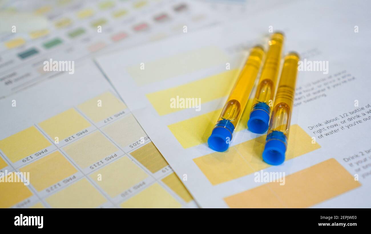 Closed urine tubes are placed on color charts. The concept of analyzes ...