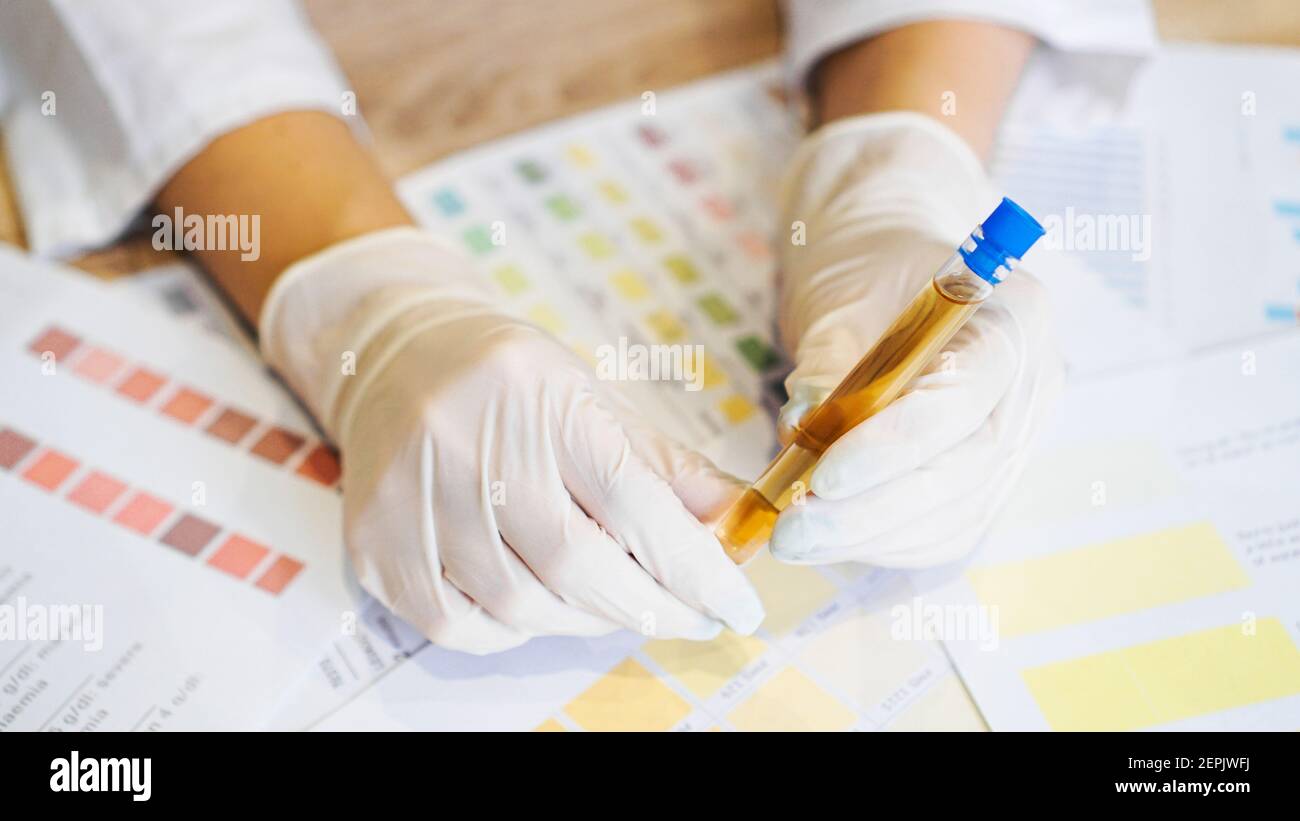 Woman making urine test with ph material in laboratory Stock Photo - Alamy