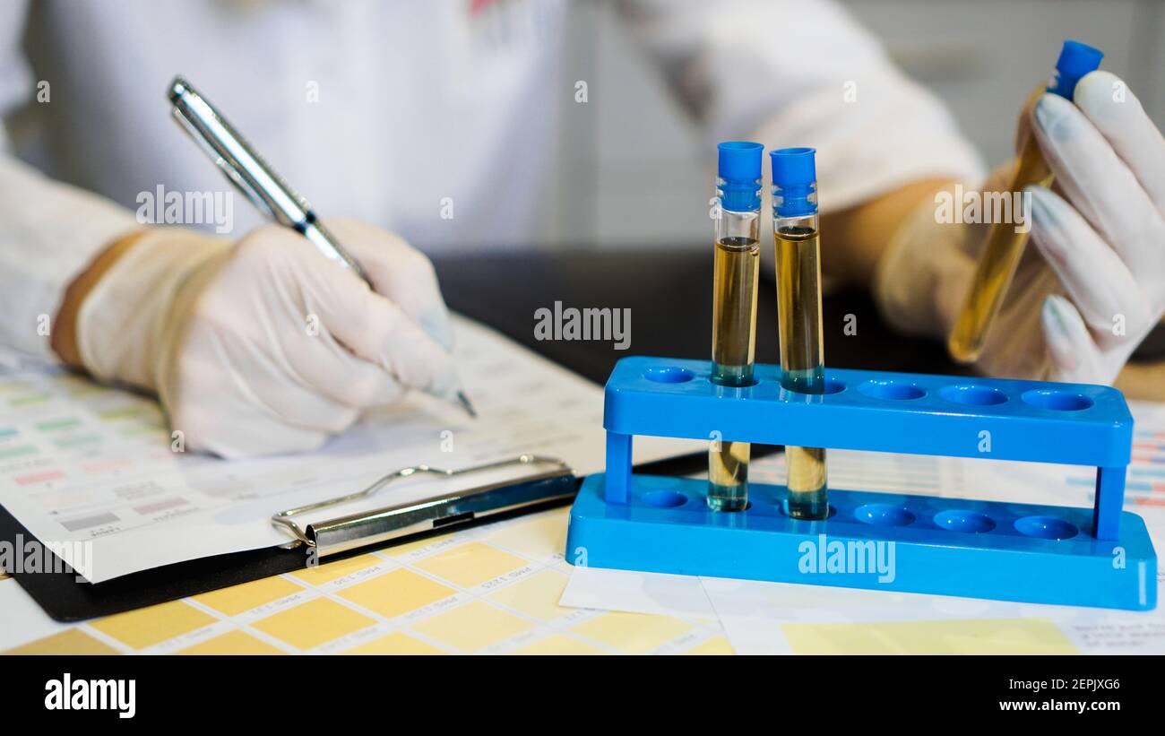 The doctor writes the results of the analysis into a form. On the table ...