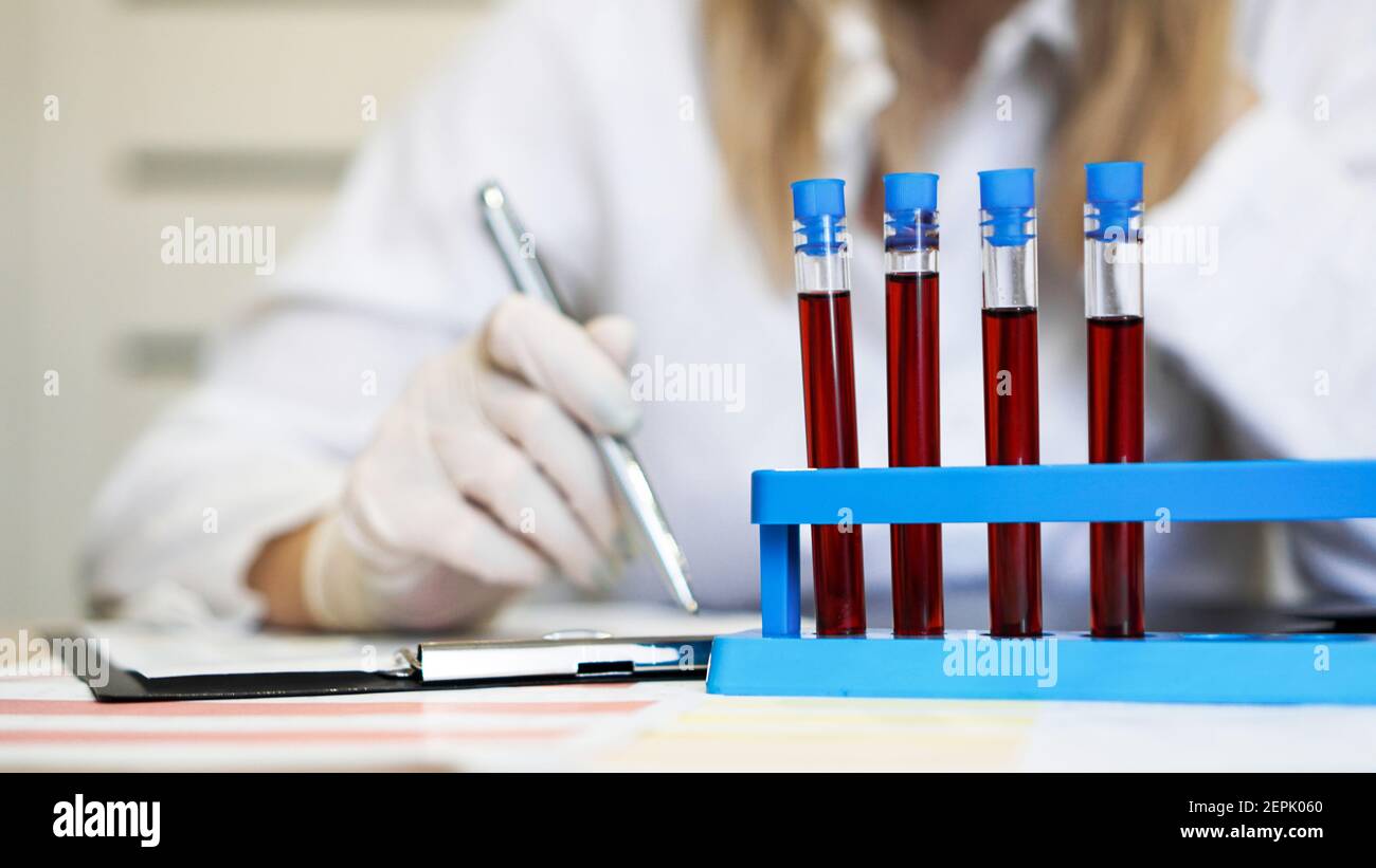 Woman working with blood samples in laboratory, closeup. The doctor ...