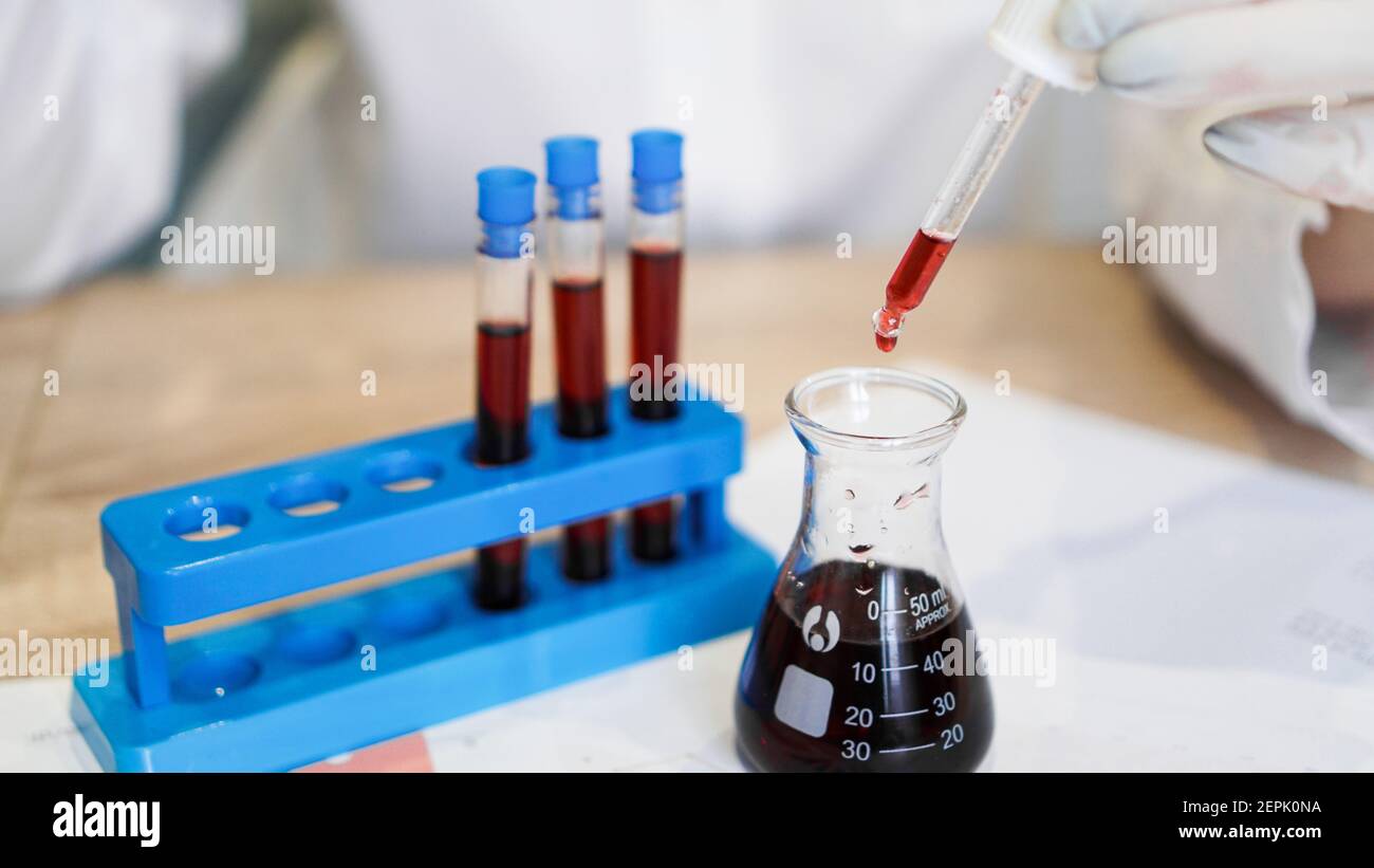 Medical pipette dropping liquid test hi-res stock photography and ...