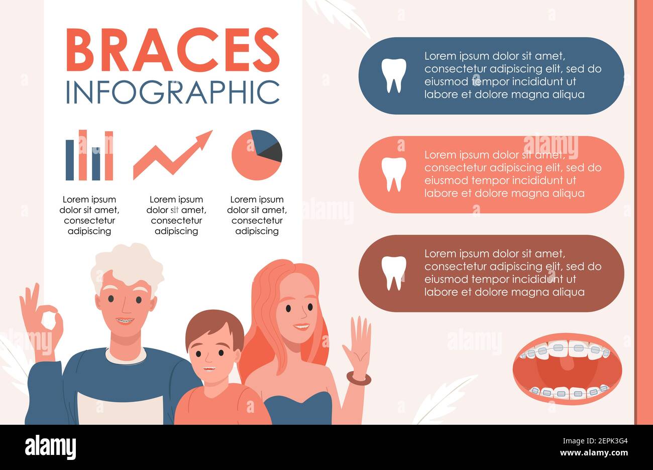 Braces infographic vector flat illustration with text and graphics ...
