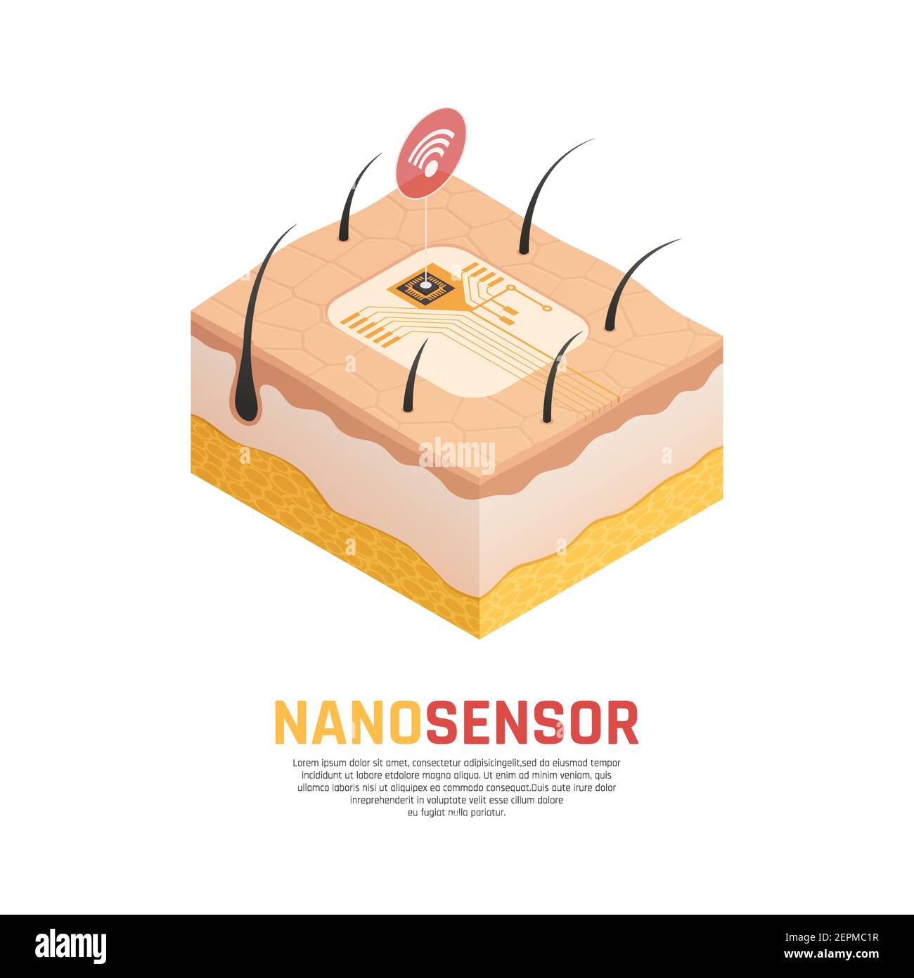 Nanotechnology based chemical and biological sensors isometric ...
