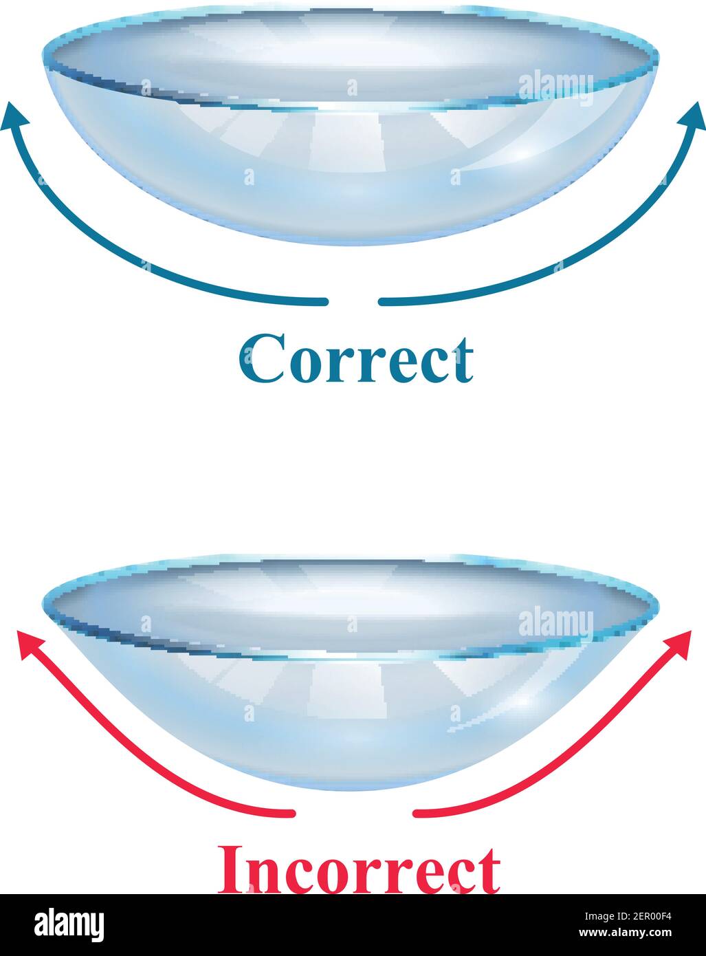 Realistic contact lenses of correct and incorrect form on white ...